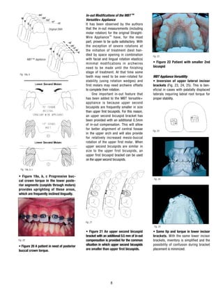 MBT TECHNIQUE - ORTHODONTIC EDUCATION FOR GENERAL PRACTITIONERS. | PDF