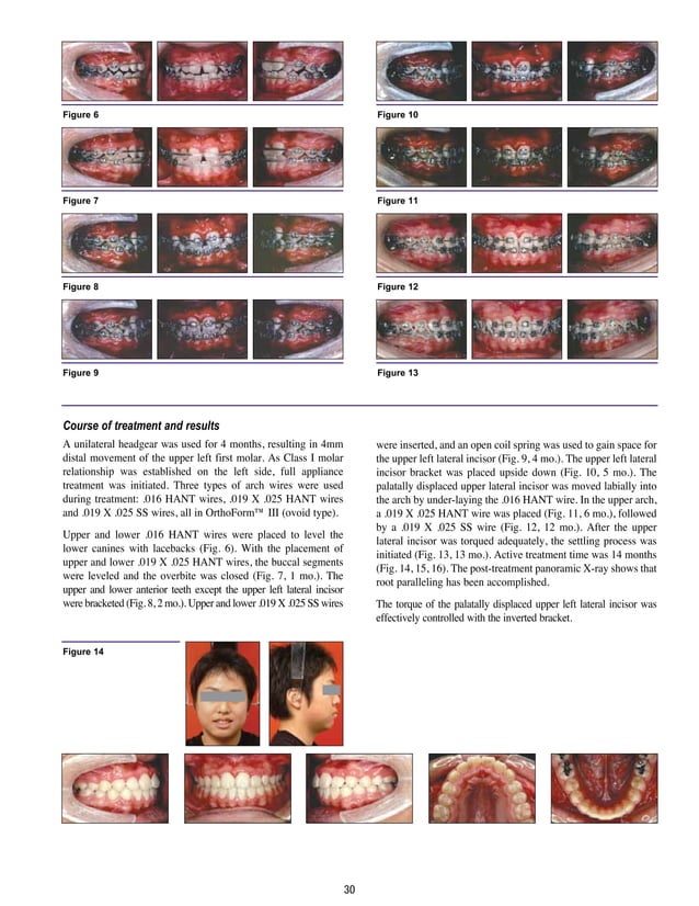 MBT TECHNIQUE - ORTHODONTIC EDUCATION FOR GENERAL PRACTITIONERS.