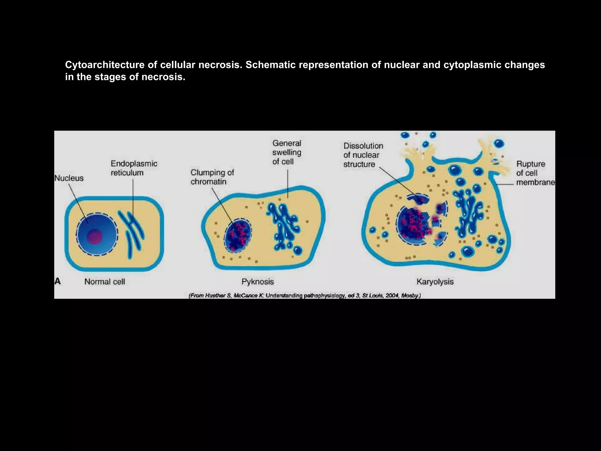 3 Necrosis And Cell Death | PPT