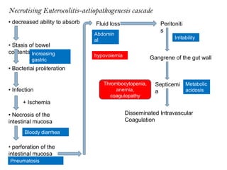 Necrotising Enterocolitis and Anesthesia | PPTX