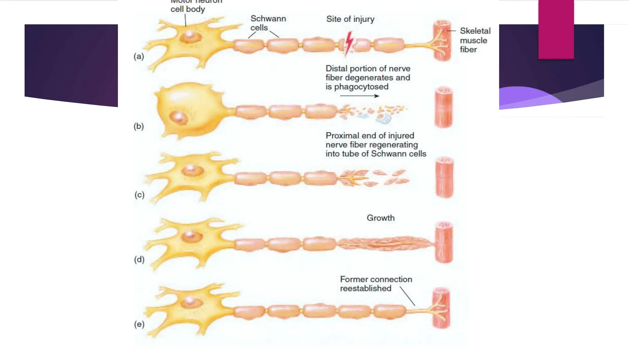 3 Nerve injury, degeneration Regeneration-.pptx