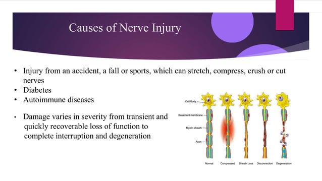 3 Nerve injury, degeneration Regeneration-.pptx | Death, Injury, or ...