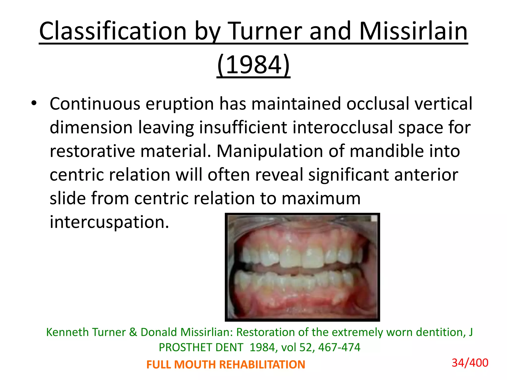 Full Mouth Rehabilitation | PPTX