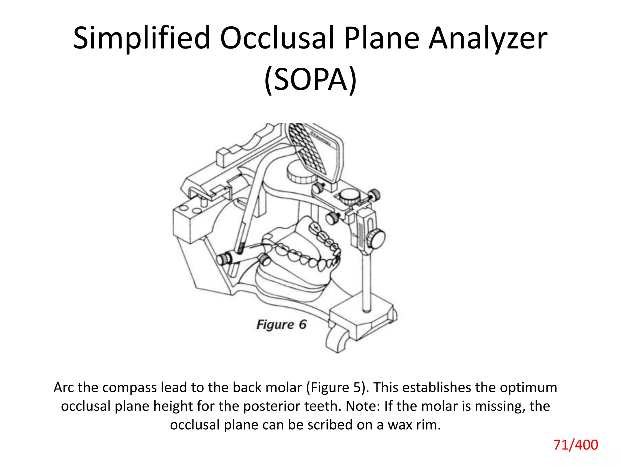 Full Mouth Rehabilitation | PPTX