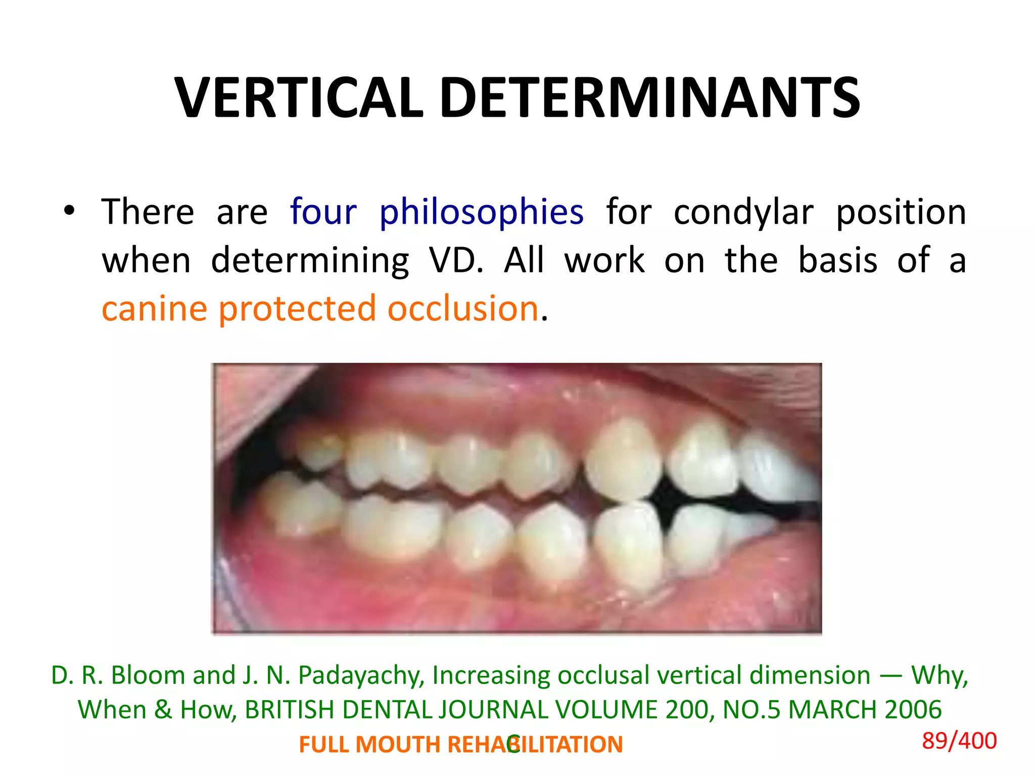 Full Mouth Rehabilitation | PPTX