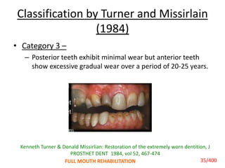 Full Mouth Rehabilitation | PPTX