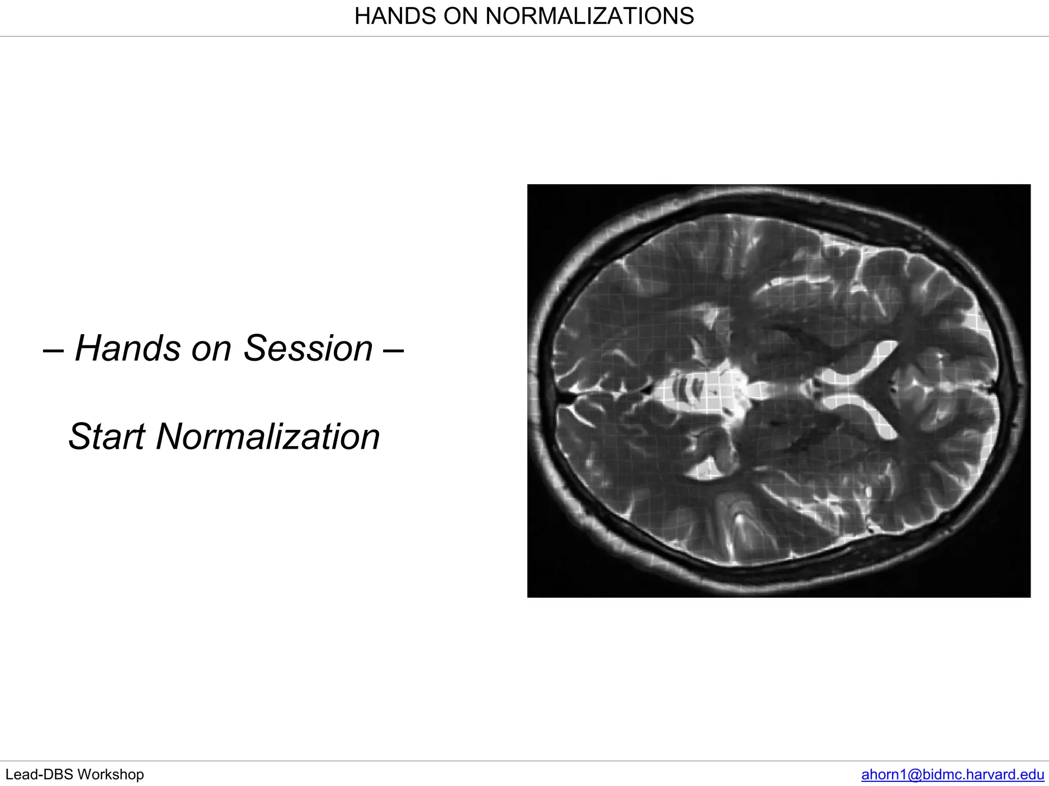 Nonlinear Deformations Atlases Spaces And Advanced Concepts Ppt