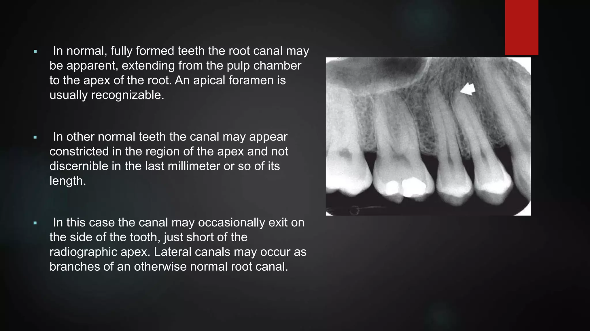 3 normal anatomy IOPA.pptx