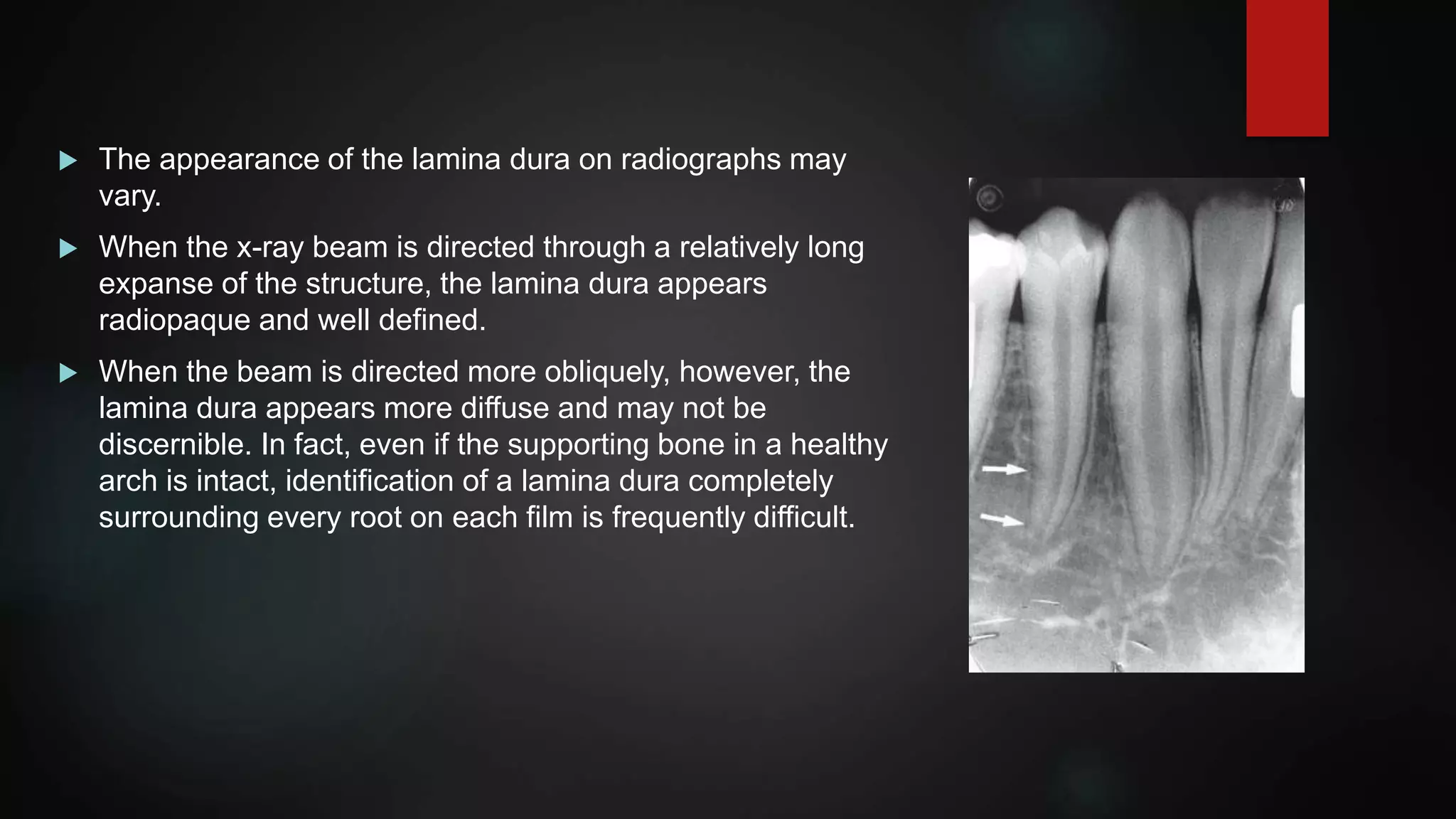 3 normal anatomy IOPA.pptx