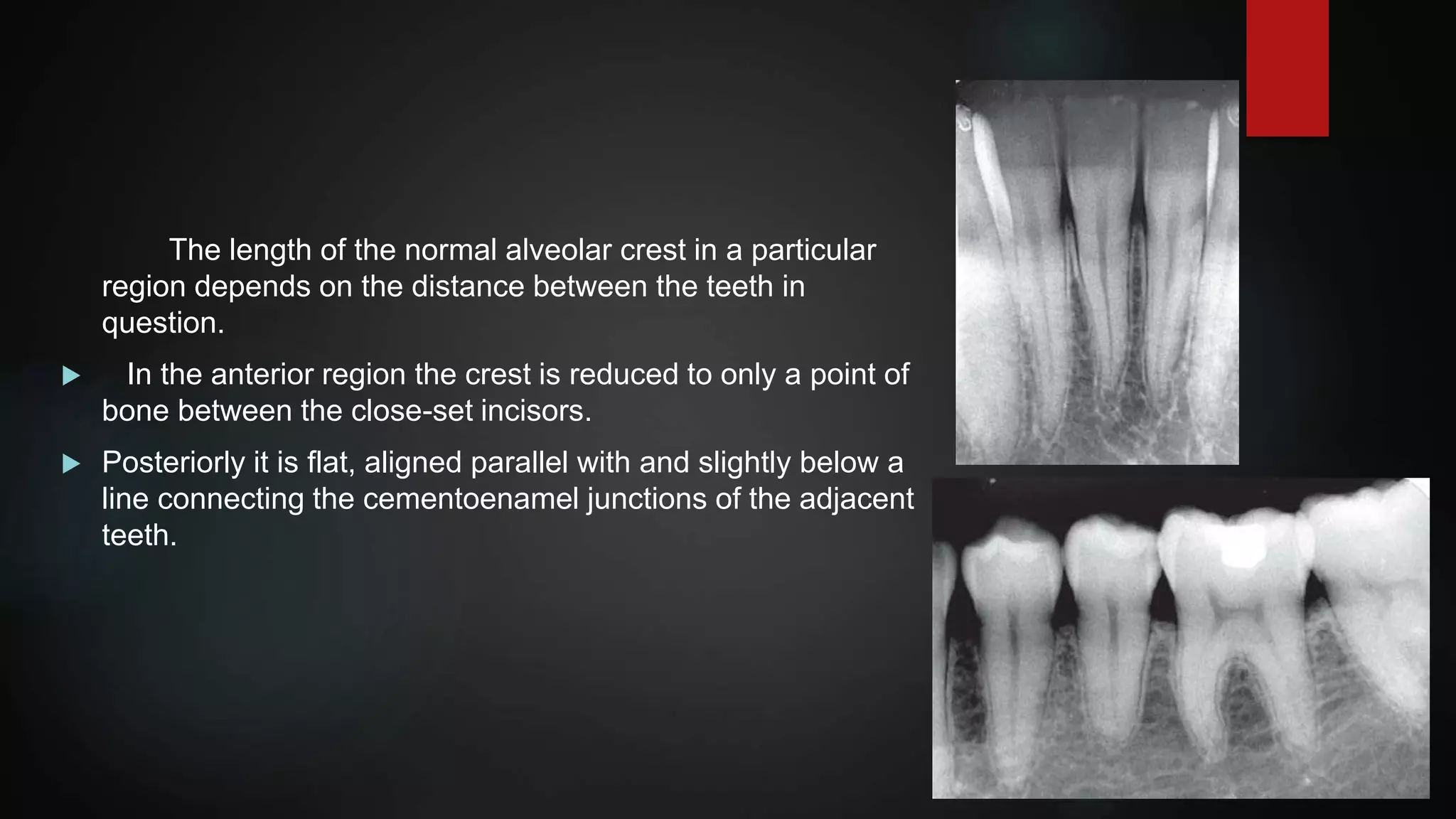 3 normal anatomy IOPA.pptx