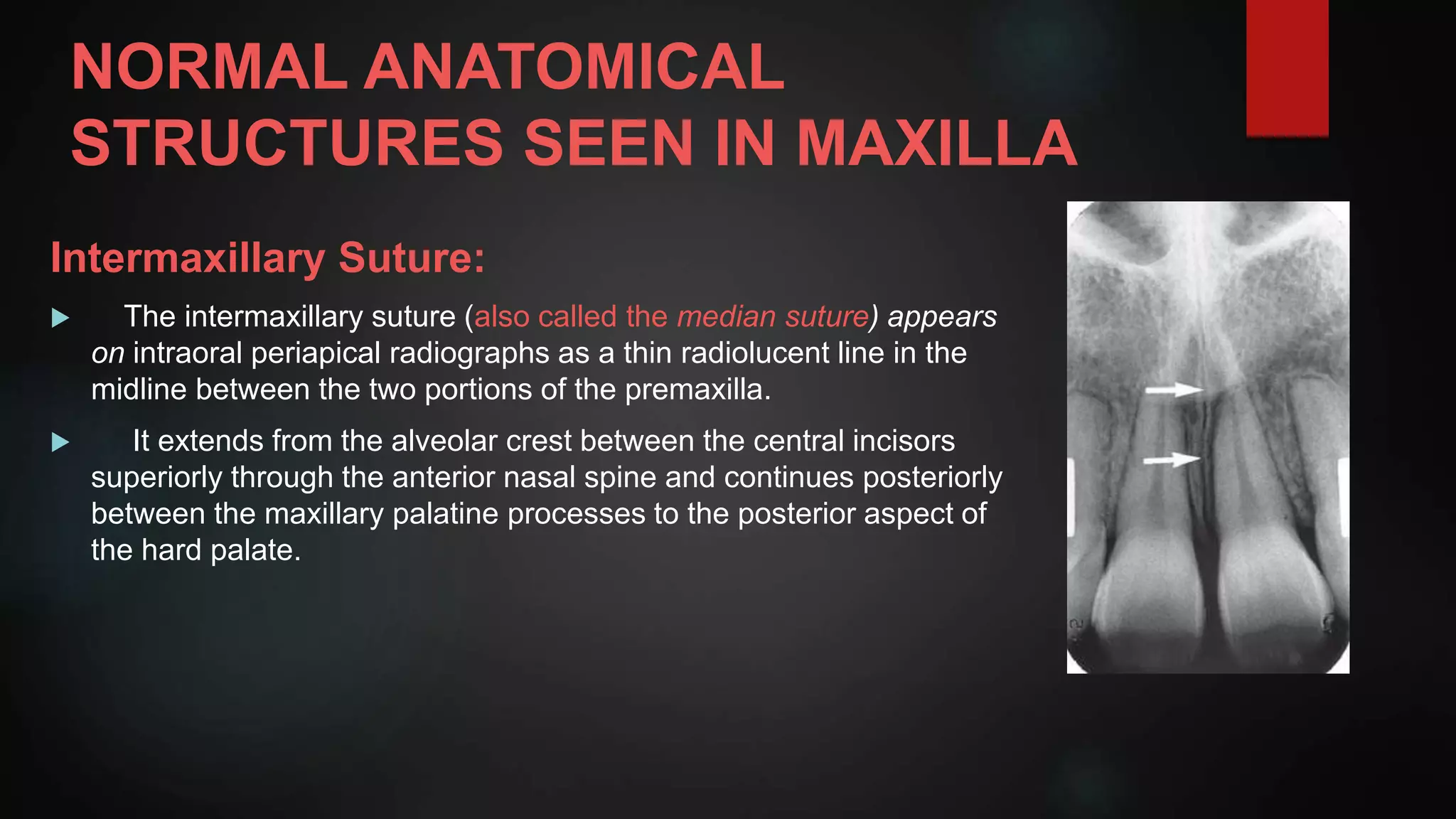 3 normal anatomy IOPA.pptx