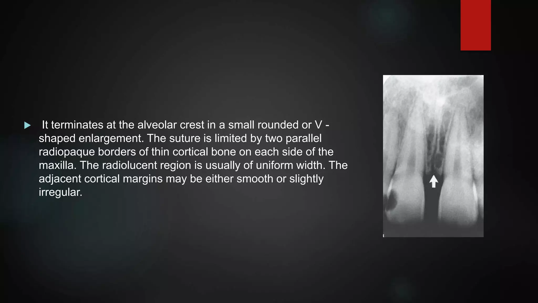 3 normal anatomy IOPA.pptx