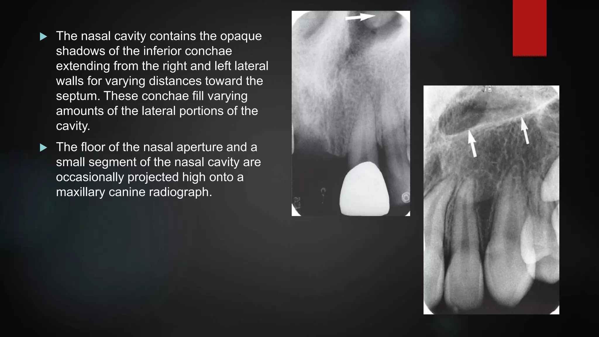 3 normal anatomy IOPA.pptx