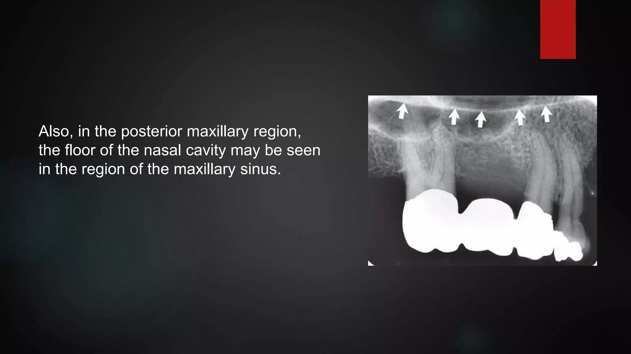 3 normal anatomy IOPA.pptx