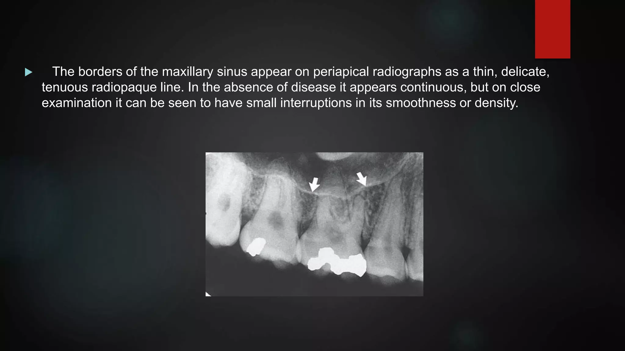 3 normal anatomy IOPA.pptx