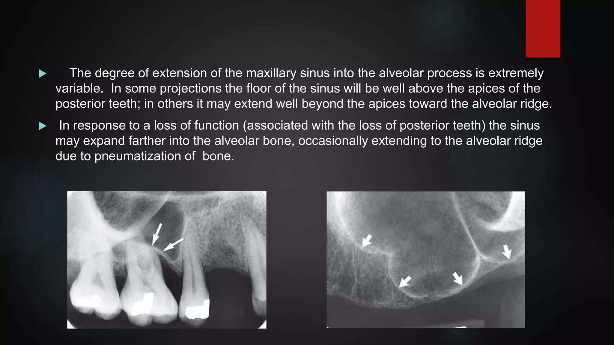 3 normal anatomy IOPA.pptx