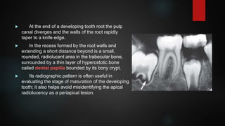 3 normal anatomy IOPA.pptx
