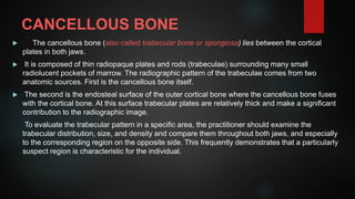 3 normal anatomy IOPA.pptx
