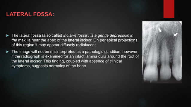 3 normal anatomy IOPA.pptx