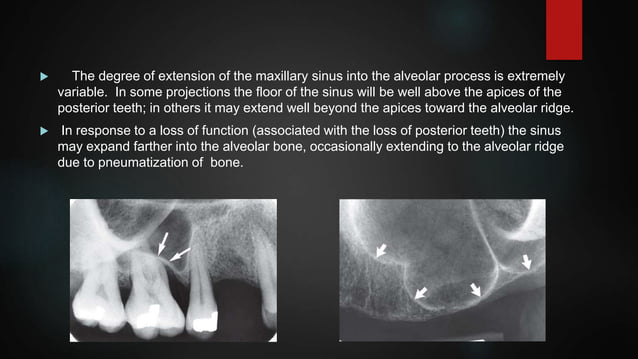 3 normal anatomy IOPA.pptx
