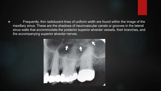 3 normal anatomy IOPA.pptx