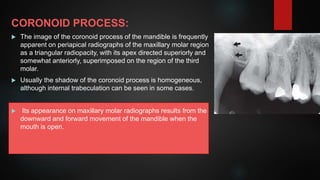 3 normal anatomy IOPA.pptx