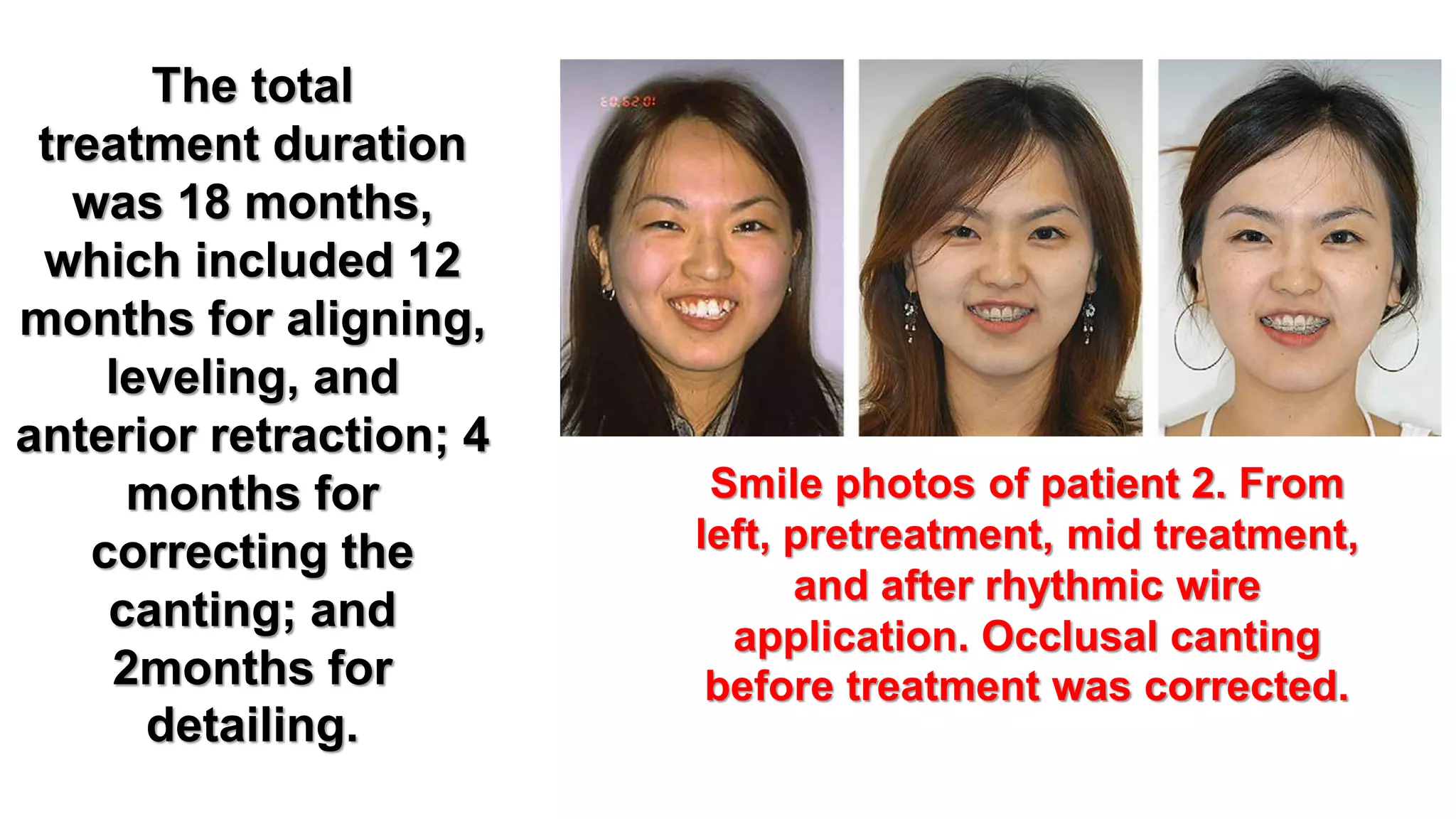 orthodontic correction of occlusal plane canting PART 3 | PPTX