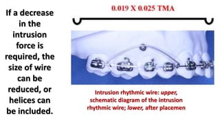 orthodontic correction of occlusal plane canting PART 3 | PPTX