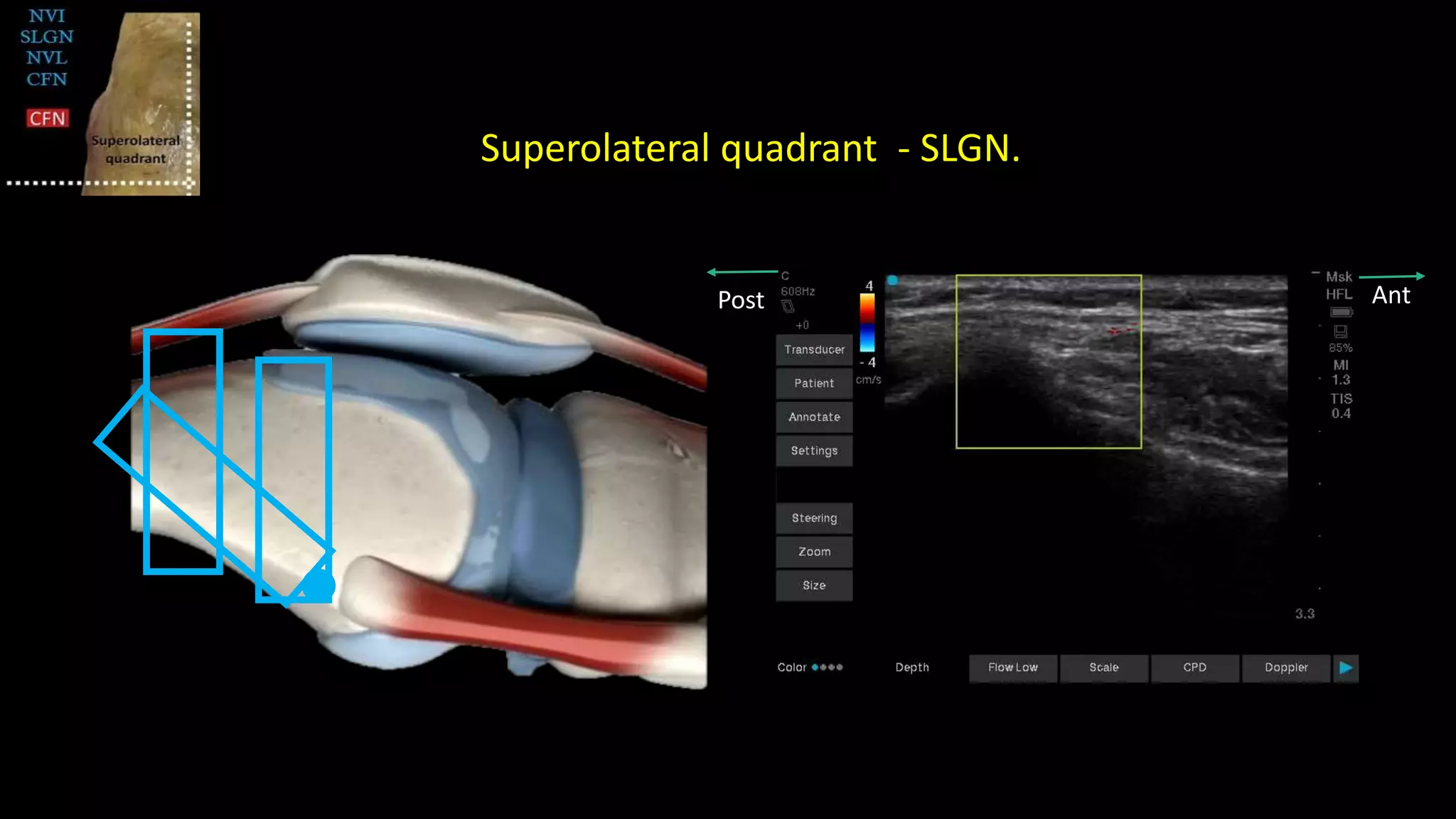 Osteoarthritis Knee.pptx