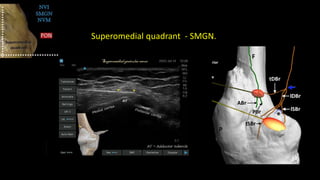 Osteoarthritis Knee.pptx