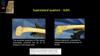 Osteoarthritis Knee.pptx