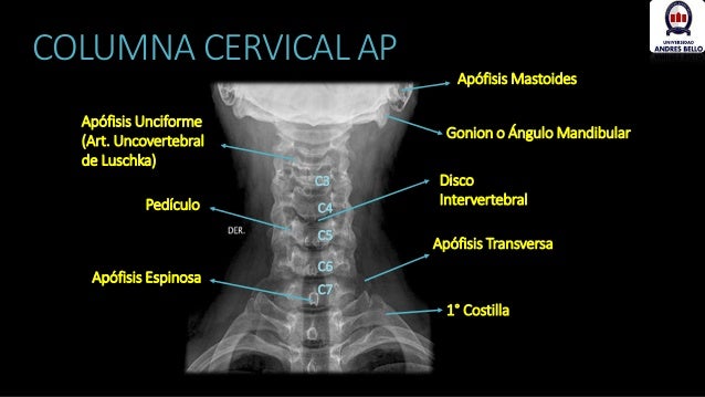 Patología radiológica de la columna vertebral