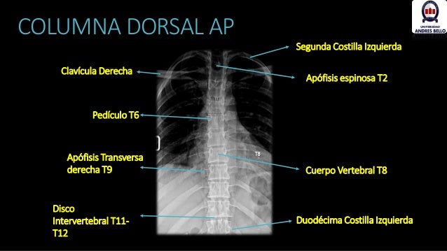 Patología radiológica de la columna vertebral