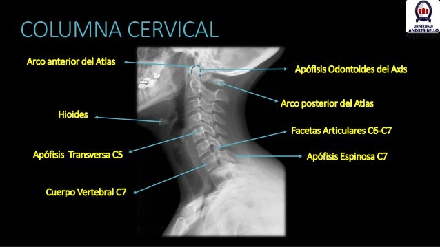 Patología radiológica de la columna vertebral