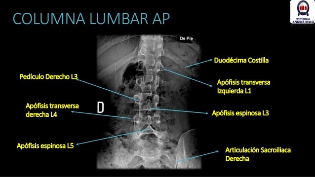 Patología radiológica de la columna vertebral