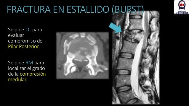 Patología radiológica de la columna vertebral
