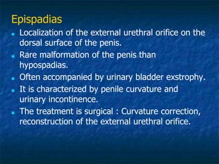 pediatric urology, anomaly.pptx