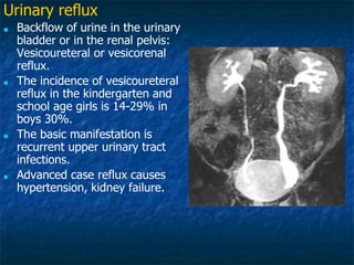 pediatric urology, anomaly.pptx