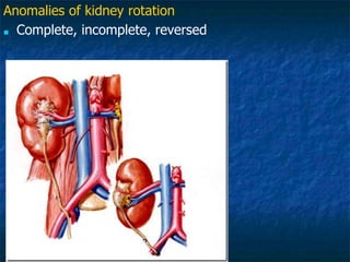 pediatric urology, anomaly.pptx