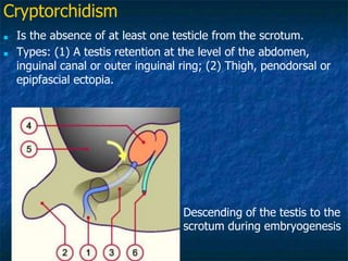 pediatric urology, anomaly.pptx