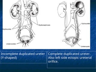 3pediatric urology, anomaly.ppt......./// | PPT