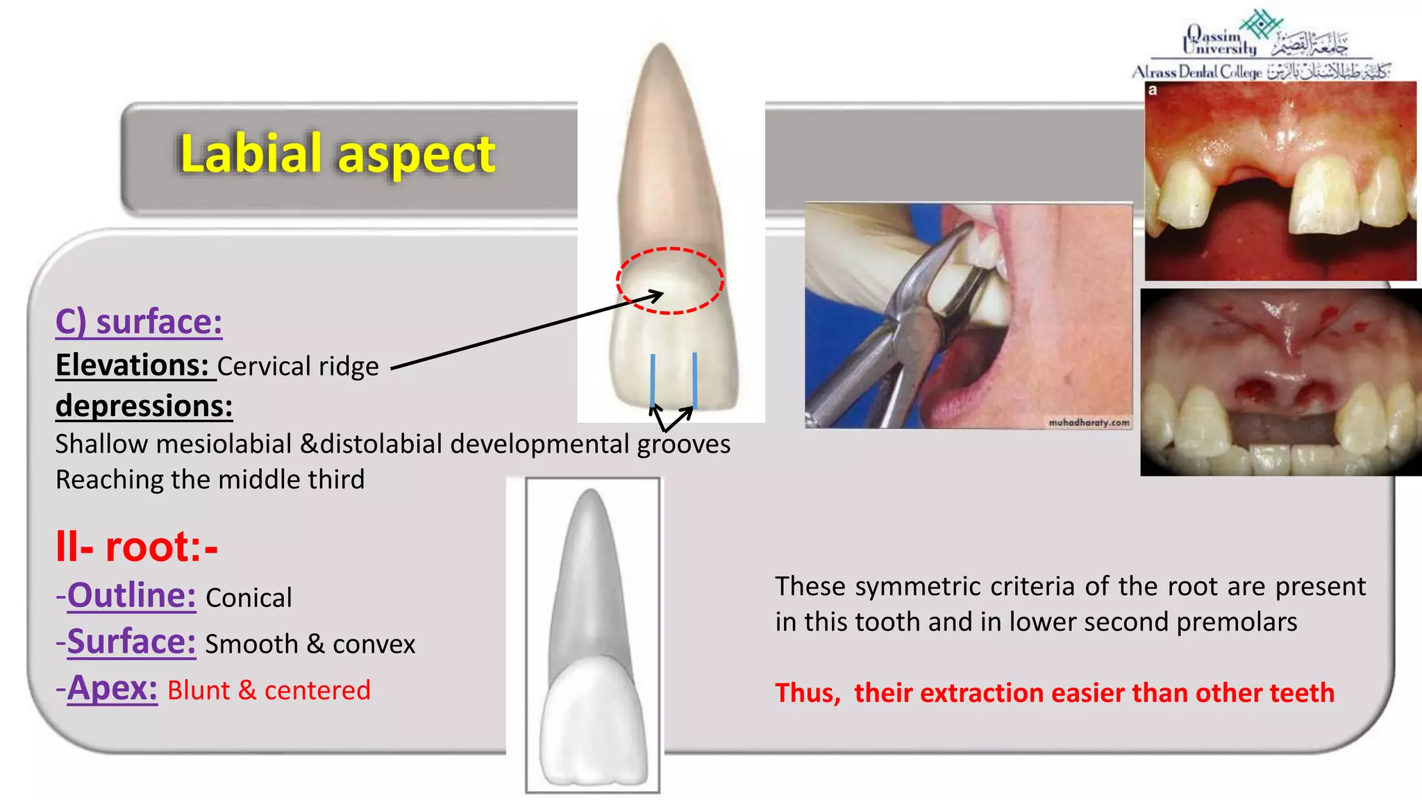 3= Permanent maxillary Central incisor.pptx