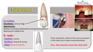 3= Permanent maxillary Central incisor.pptx