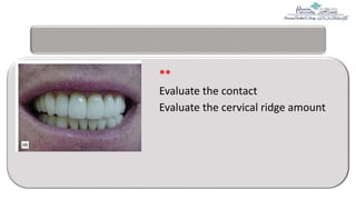 3= Permanent maxillary Central incisor.pptx