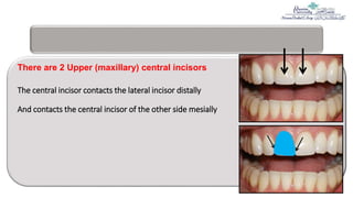3= Permanent maxillary Central incisor.pptx