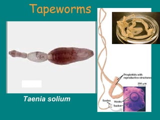 3 phylum platyhelminthes | PPS