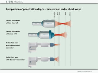 Physics of shock waves | PPT
