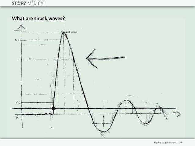 Physics of shock waves
