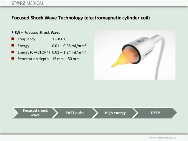 Physics of shock waves