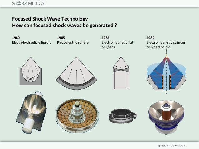 Physics of shock waves
